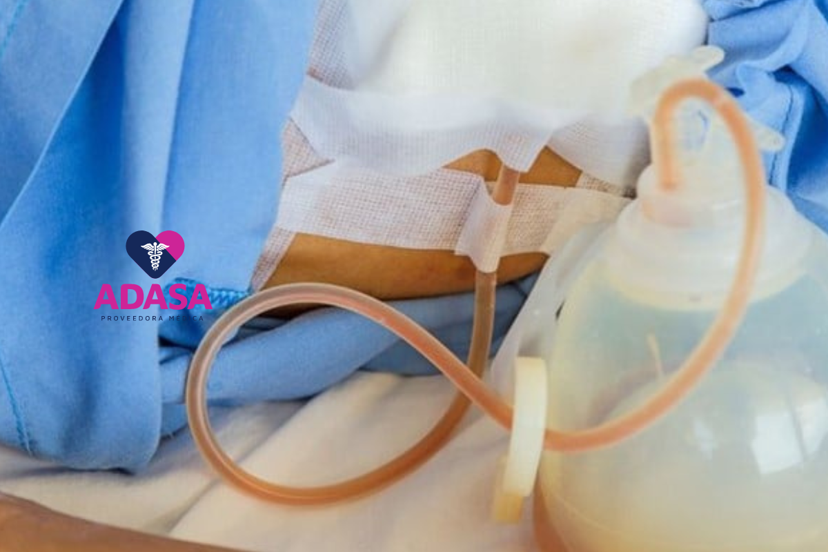 Drenajes quirúrgicos y reservorios: Qué debes saber - Proveedora Medica ...